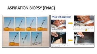 Biopsy of tissues and muscles Definition | PDF