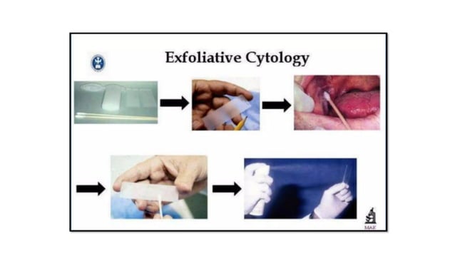 Biopsy of tissues and muscles Definition | PPT