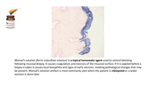 Biopsy of tissues and muscles Definition | PPT