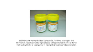 Biopsy of tissues and muscles Definition | PPT