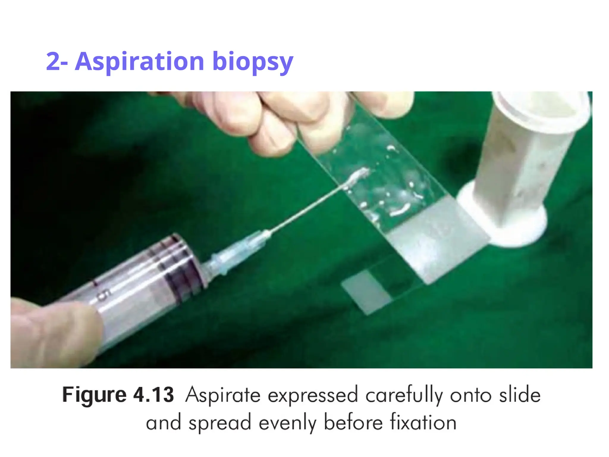 Biopsy in oral (oral Pathology Lab )٠.pptx