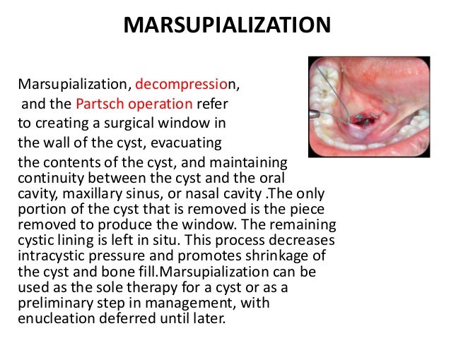 Marsupialisation Veterinary Medicine, Surgery, Singapore, Toa Payoh