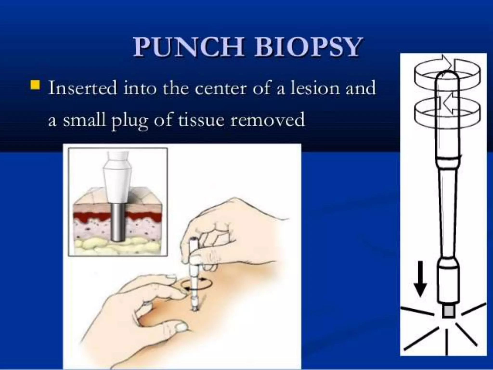 Biopsy and Exfoliative Cytology | PPTX