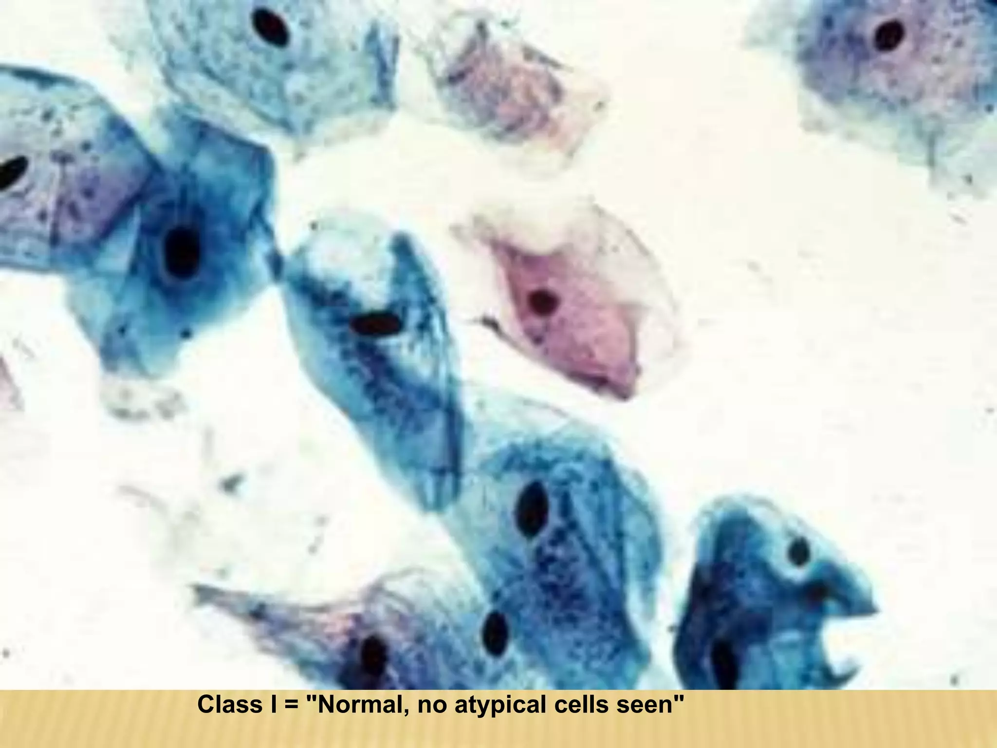 Biopsy and Exfoliative Cytology | PPTX
