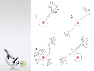 Multipolar Neuron Unlabeled