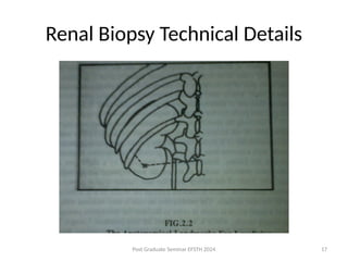 Renal biopsy to assess kidney diseases in adult | PPT