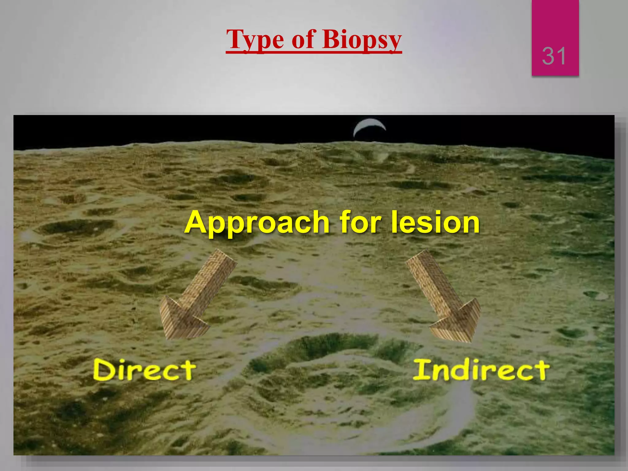 Biopsy final.ppt