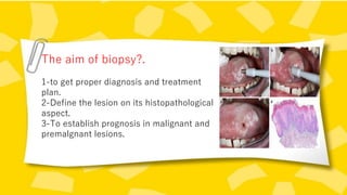 Biopsy final to Diagnosis lesions for academic density.pdf