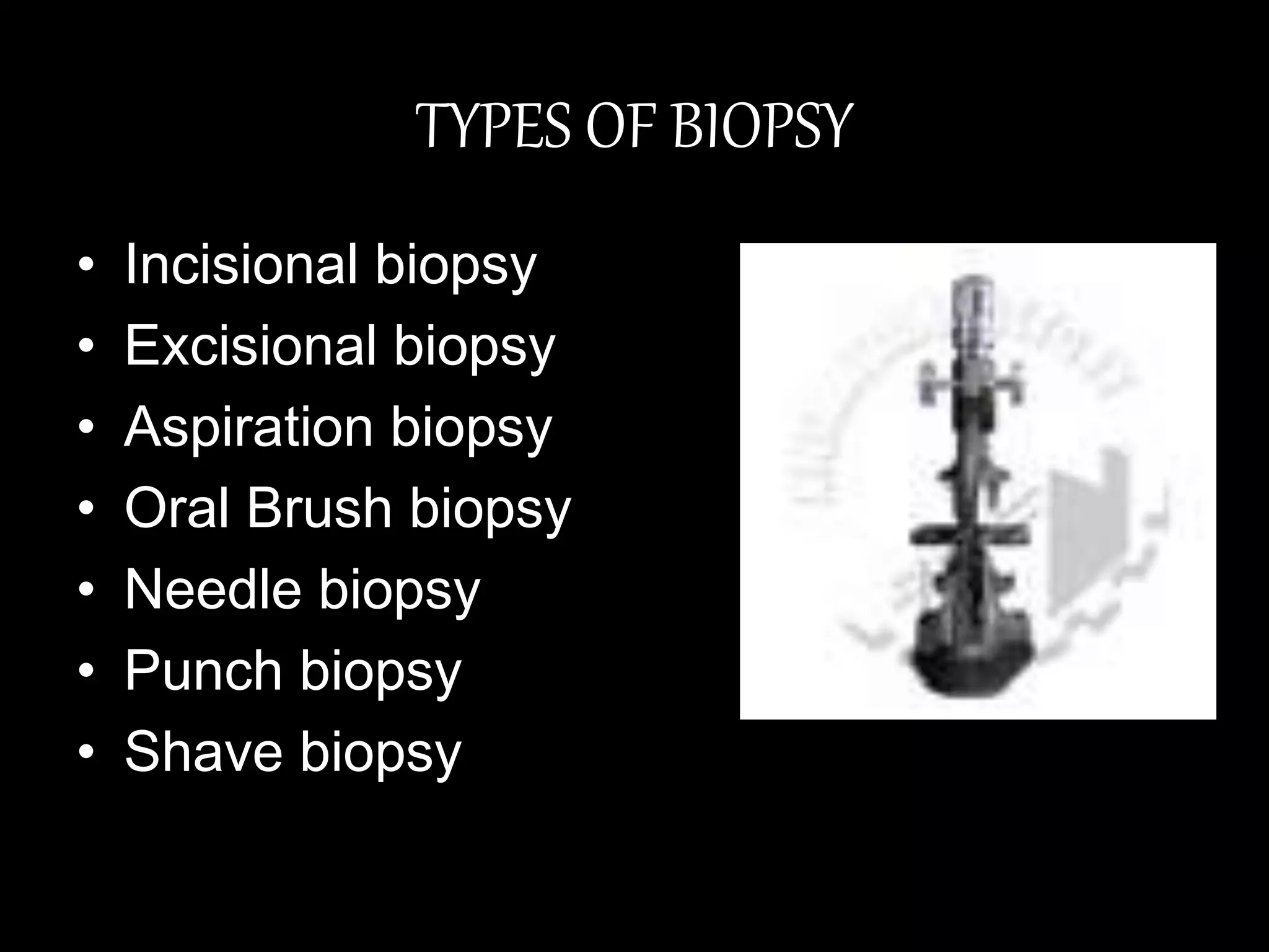 Biopsy for presentation | PPT