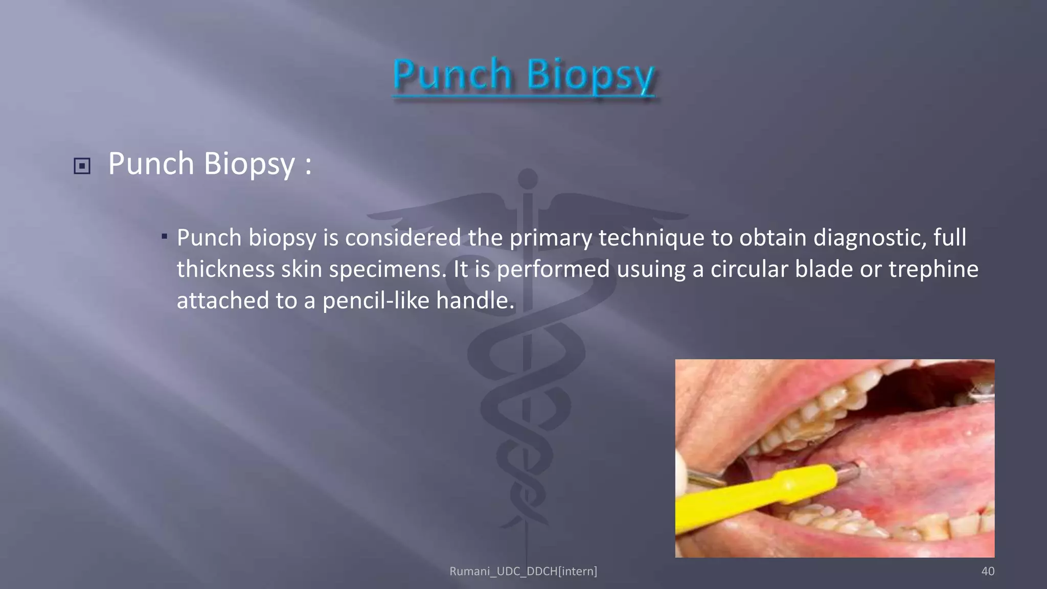 Biopsy in Oral Surgery | PPTX