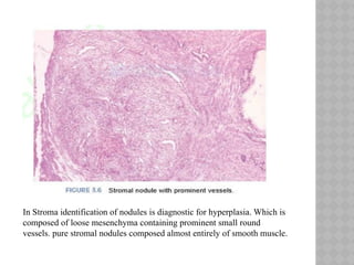 Biopsy interpretation of prostate disease | PPTX
