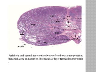 Biopsy interpretation of prostate disease | PPTX