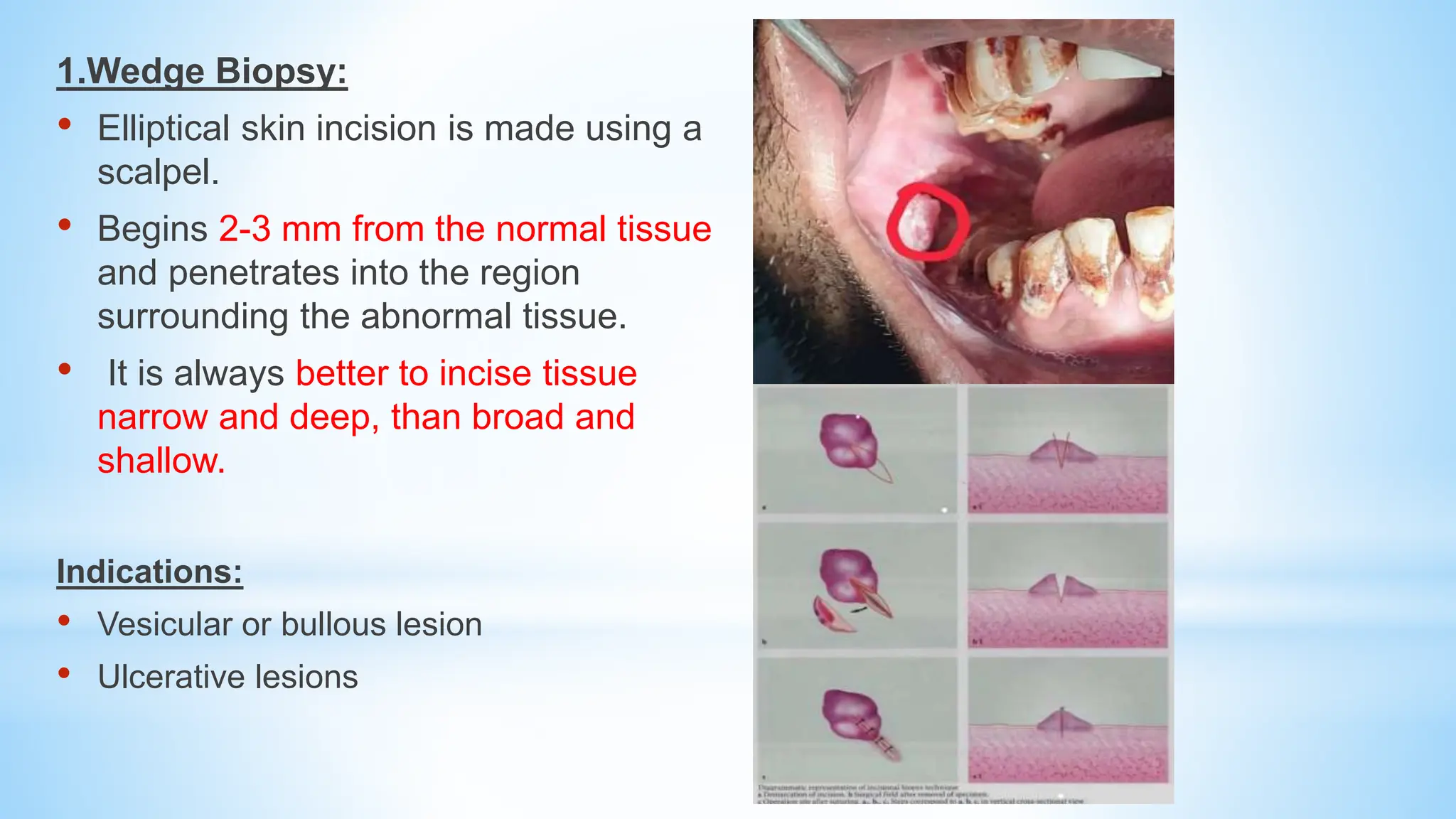 Oral Biopsy Methods Used In Surgical practice | PPTX