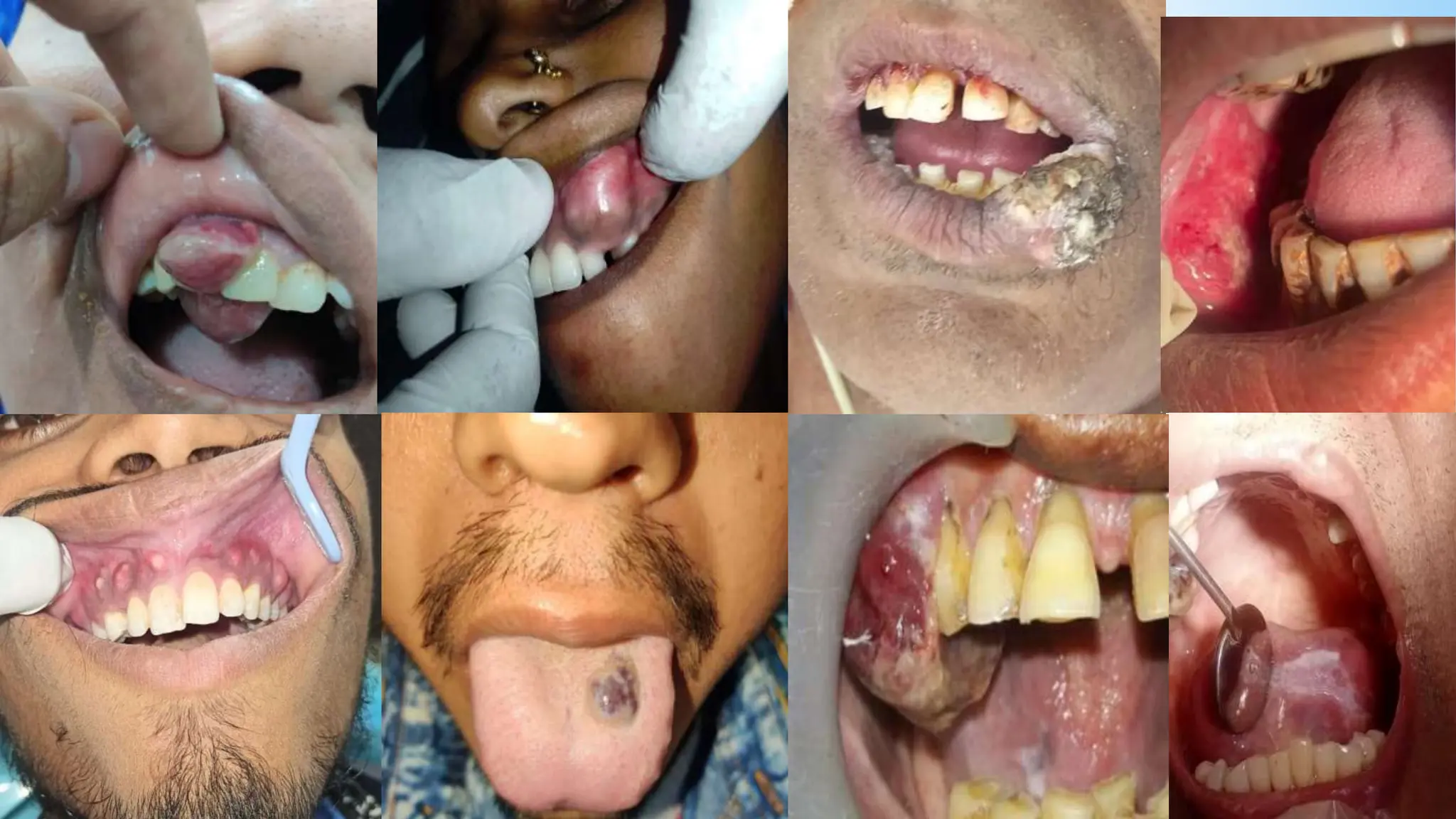 Oral Biopsy Methods Used In Surgical practice | PPTX