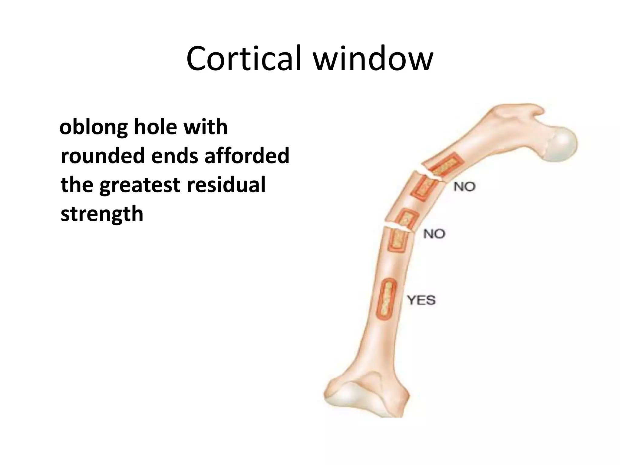 Biopsy of bone tumors | PPTX