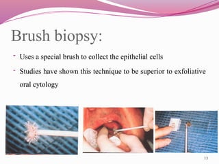 Biopsy & Aspiration Cytology in Oral and Maxillofacial Surgery | PPTX