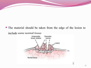 Biopsy & Aspiration Cytology in Oral and Maxillofacial Surgery | PPTX