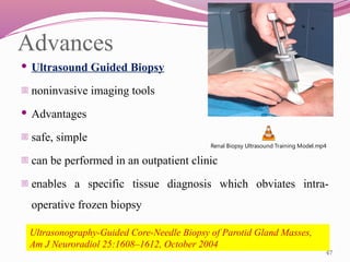 Biopsy & Aspiration Cytology in Oral and Maxillofacial Surgery | PPTX