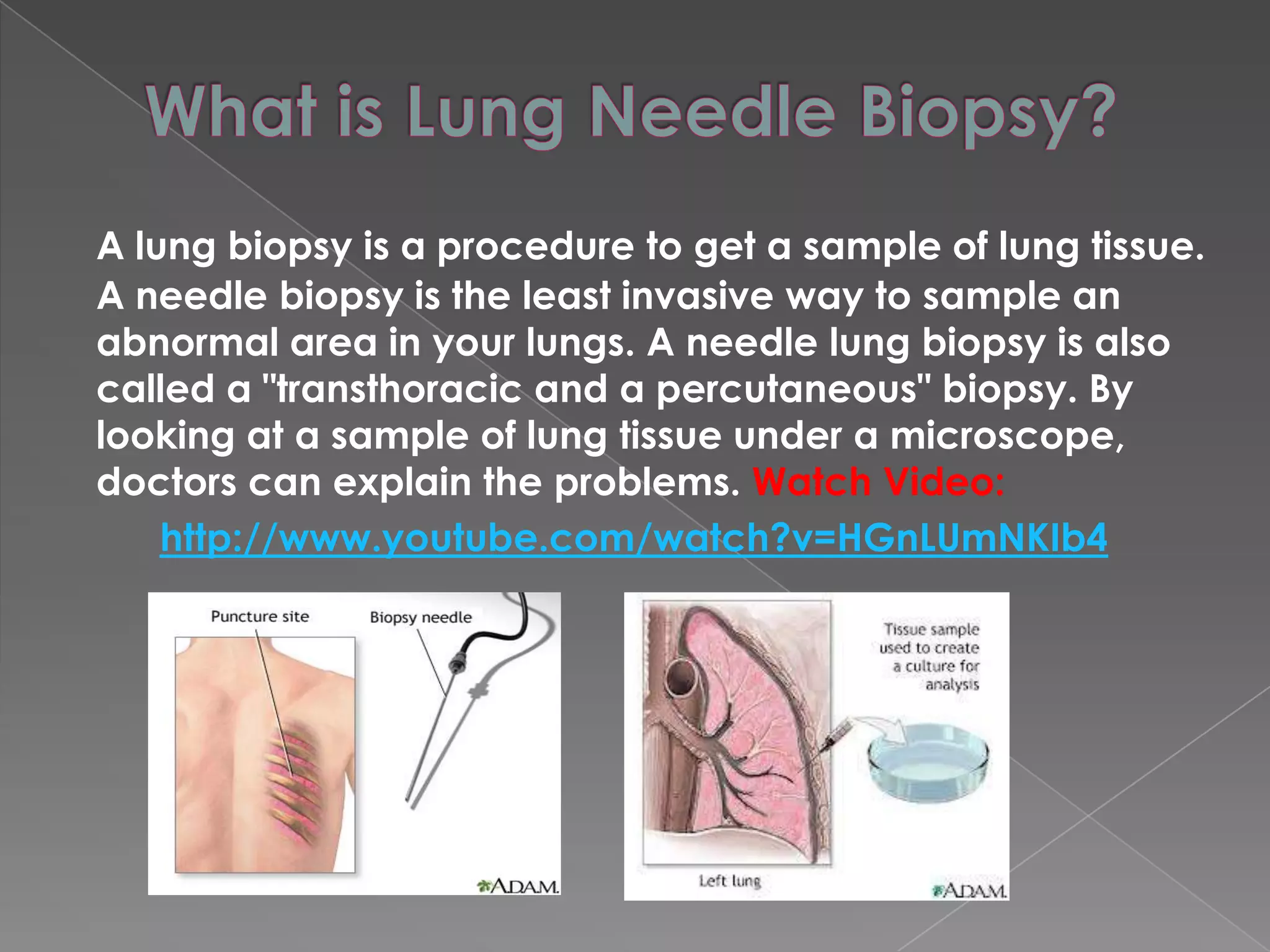 Biopsy project | PPTX