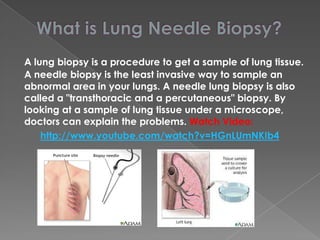 Biopsy project | PPTX