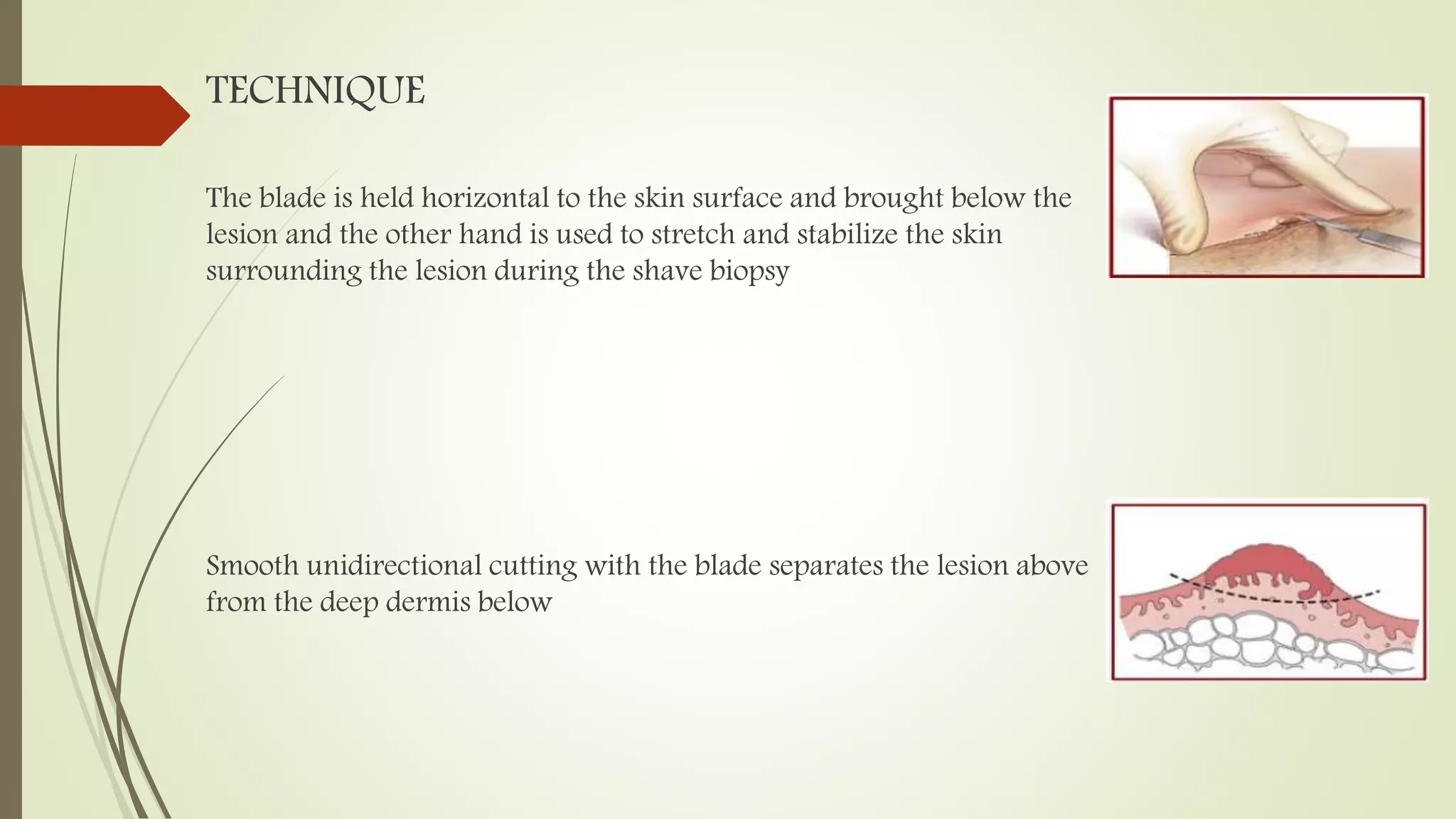 biopsy technique.pptx