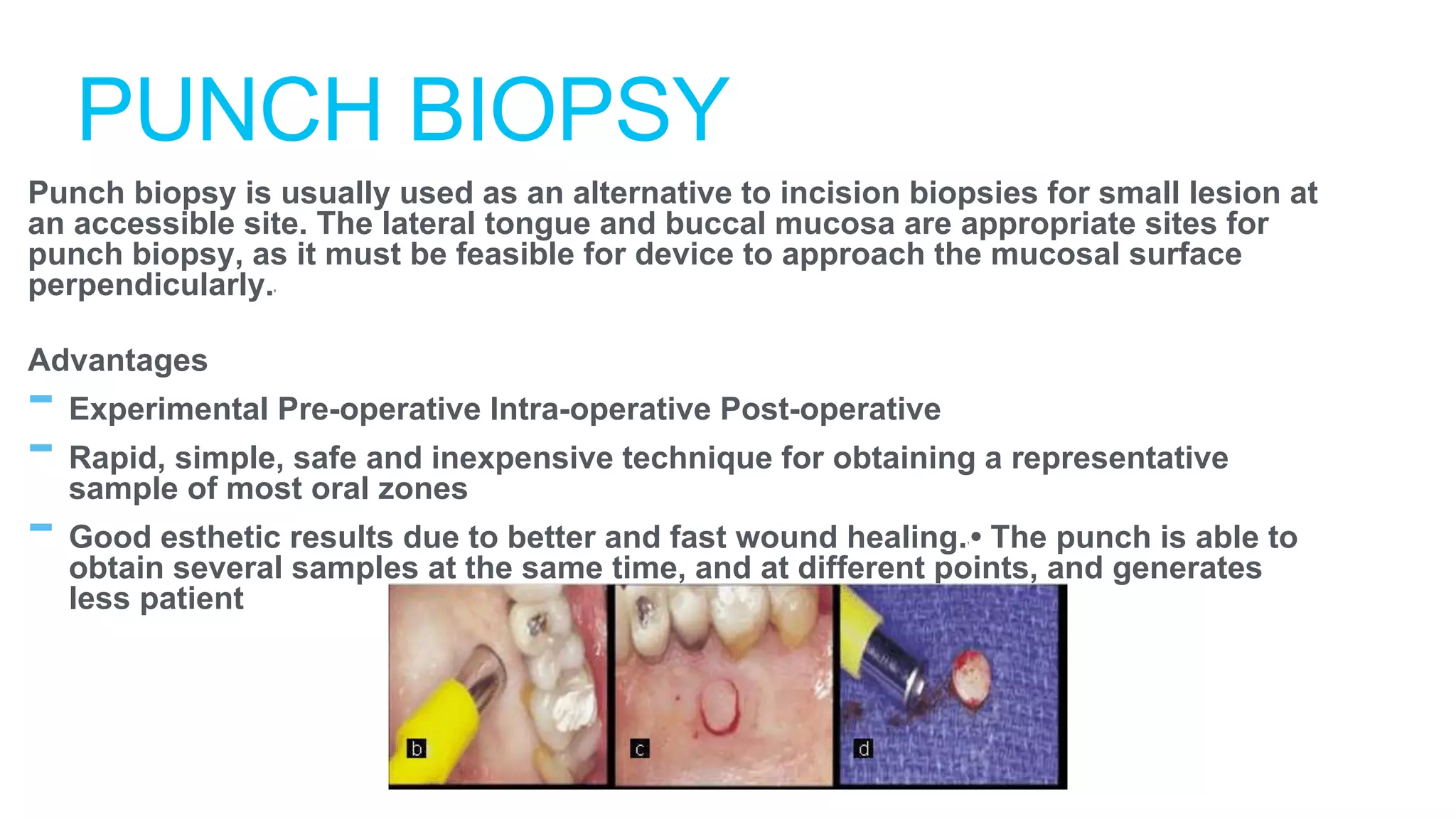 Biopsy Techniques.pptx