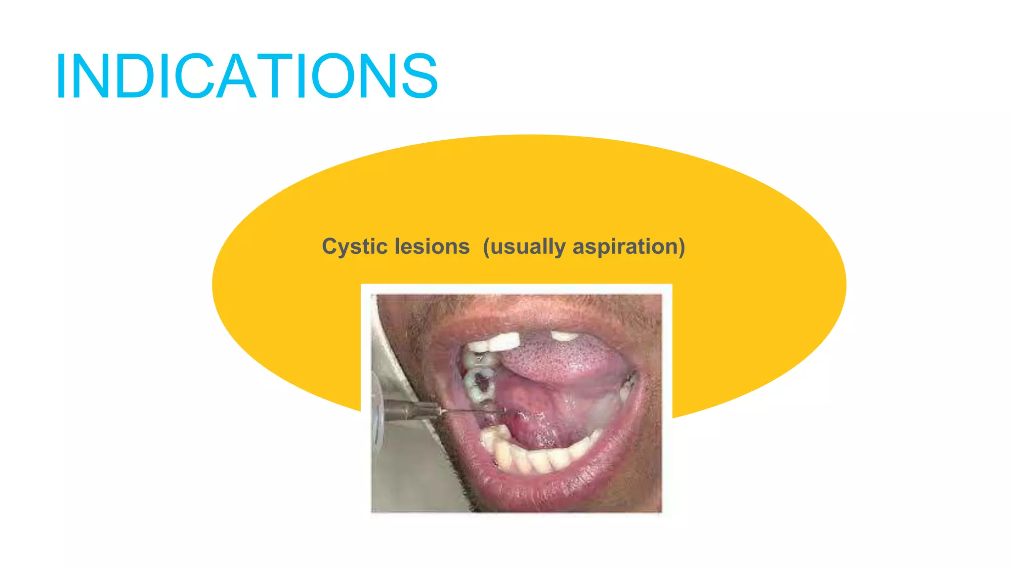 Biopsy Techniques.pptx