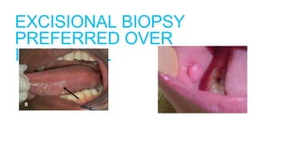 Biopsy Techniques.pptx