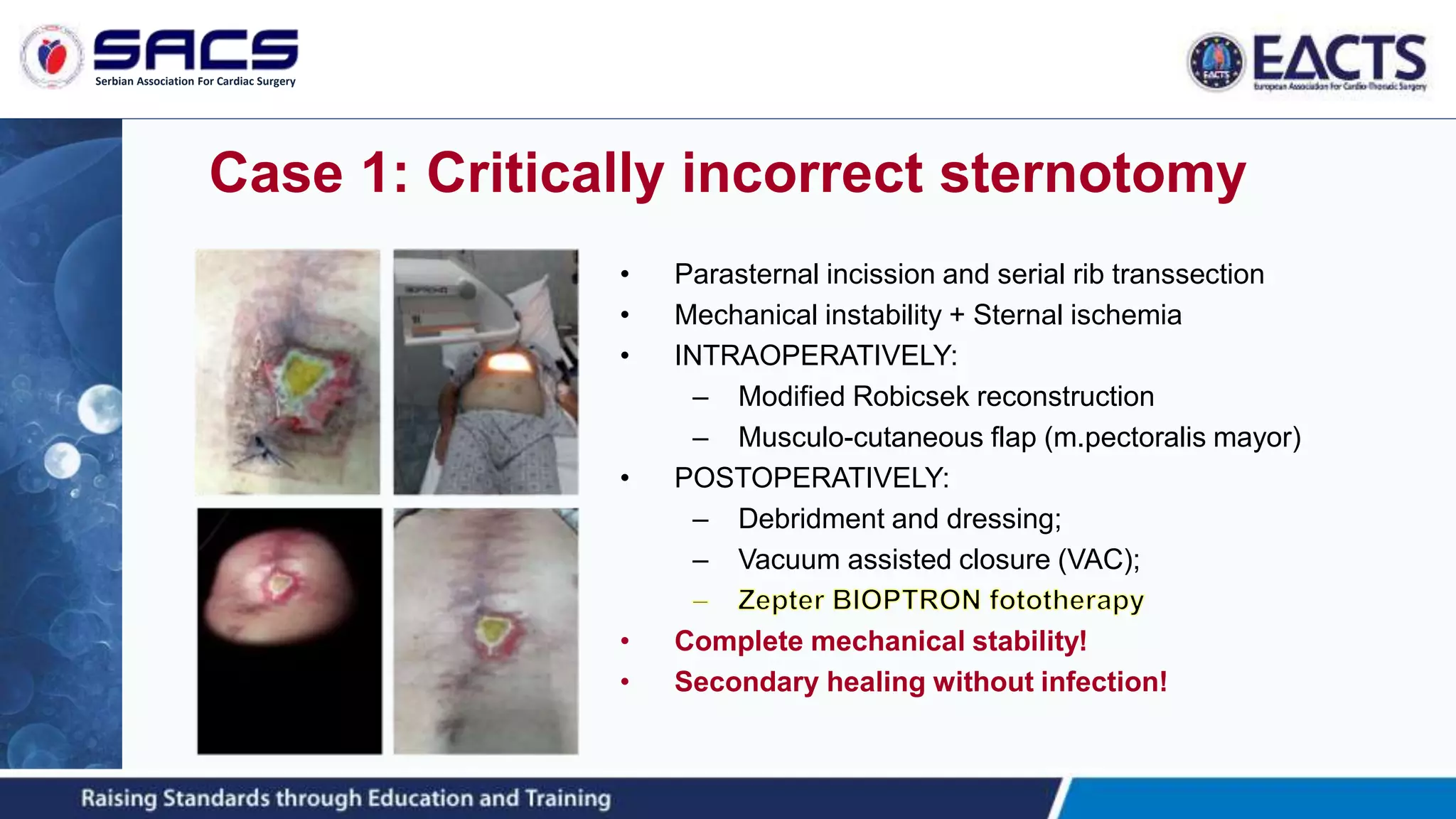 BIOPTRON - CARDIAC SURGERY - KOCICA.pptx