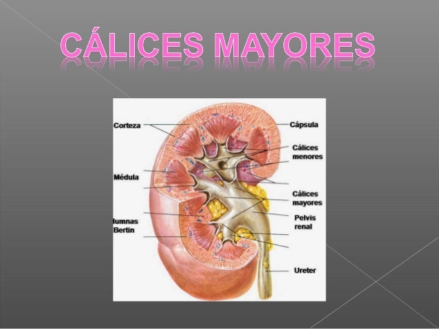 Calices