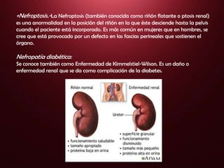 Bioquimica del riñon | PPTX
