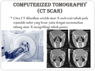 bioradiasi pada fisika kebidanan adalah.ppt