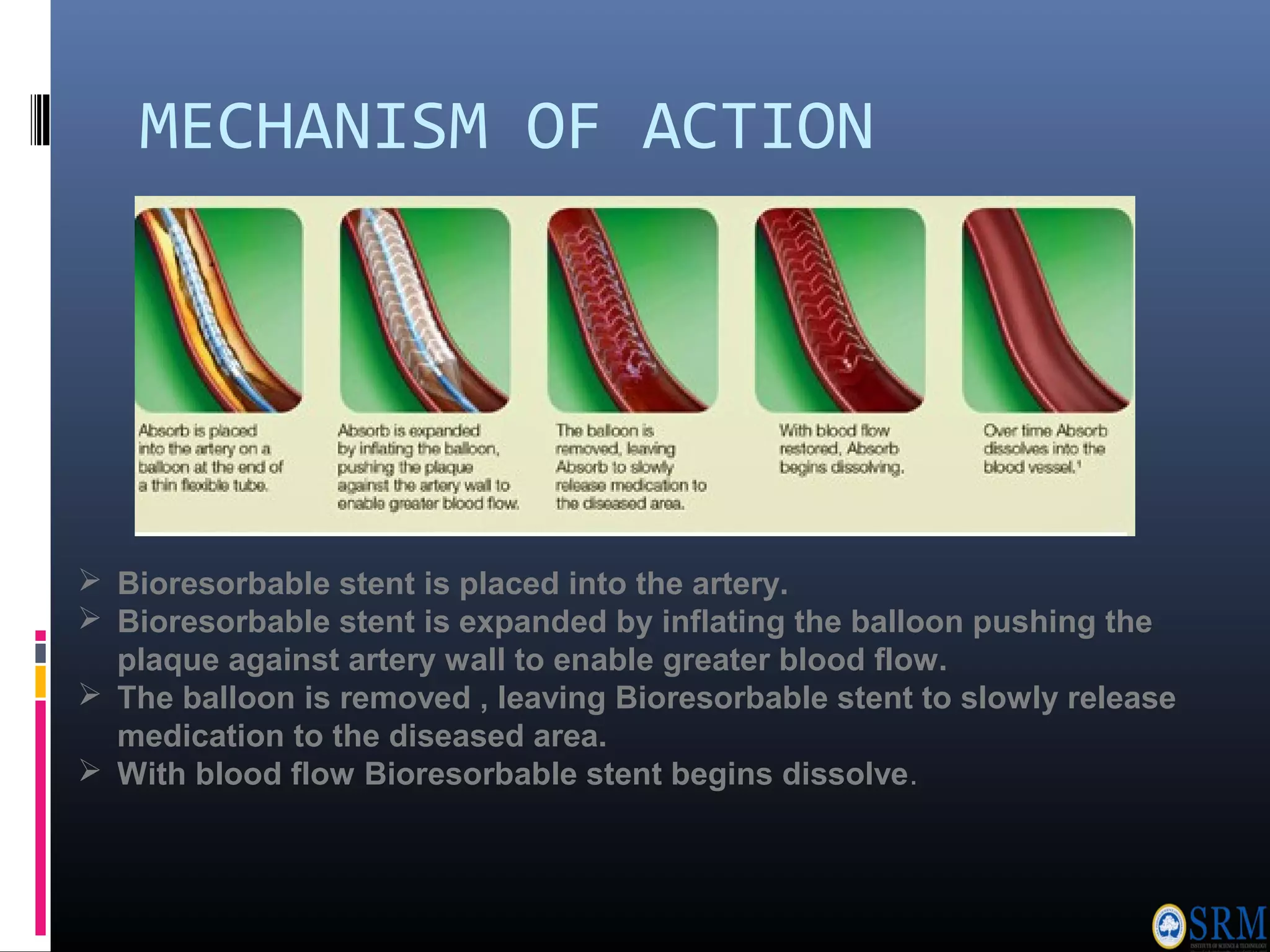 Bioresorbable stents in treatment of coronory heart disease | PPT