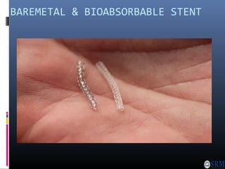 Bioresorbable stents in treatment of coronory heart disease | PPT