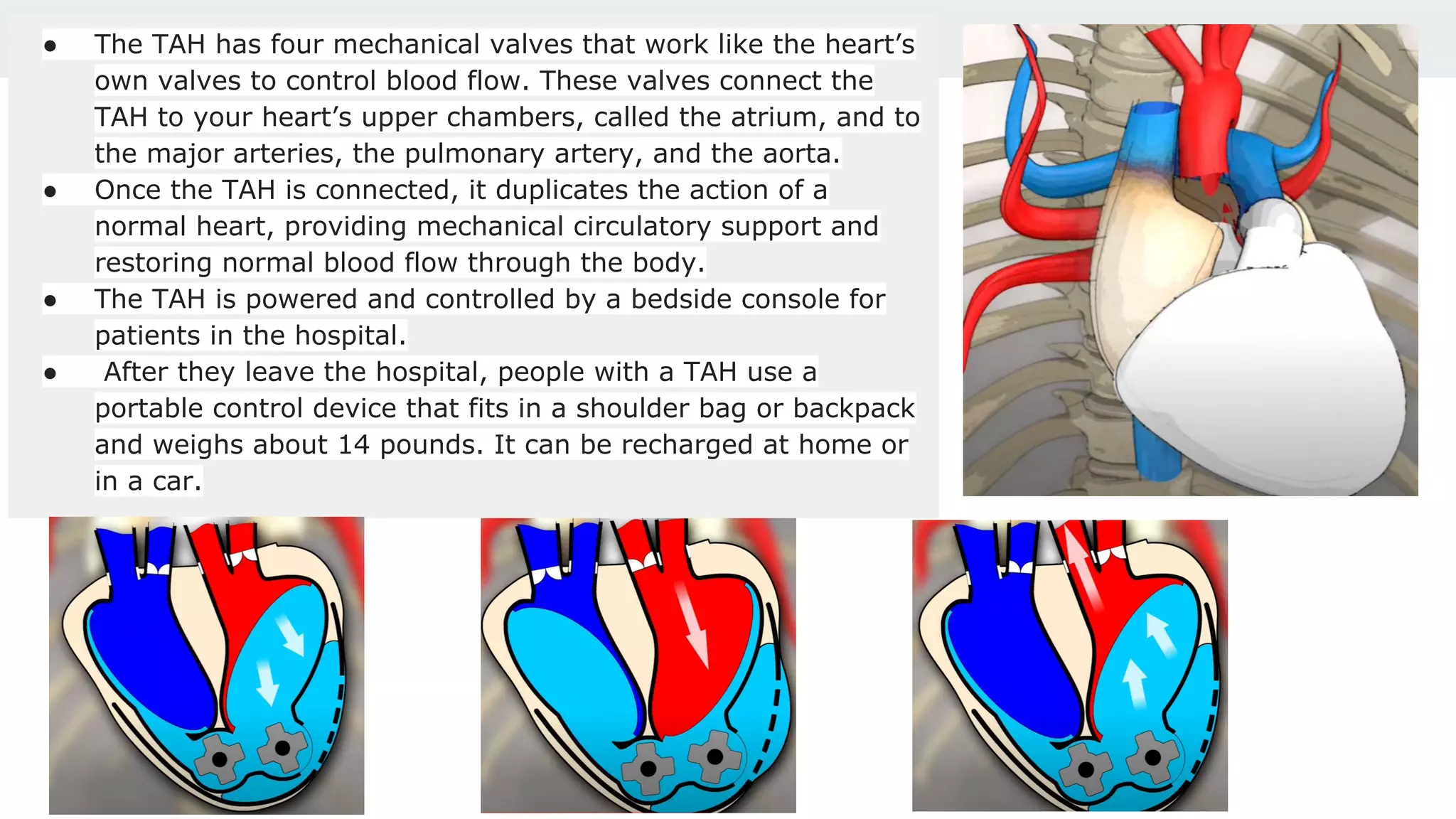 Bio Sensors and Artificial Heart Technology | PDF