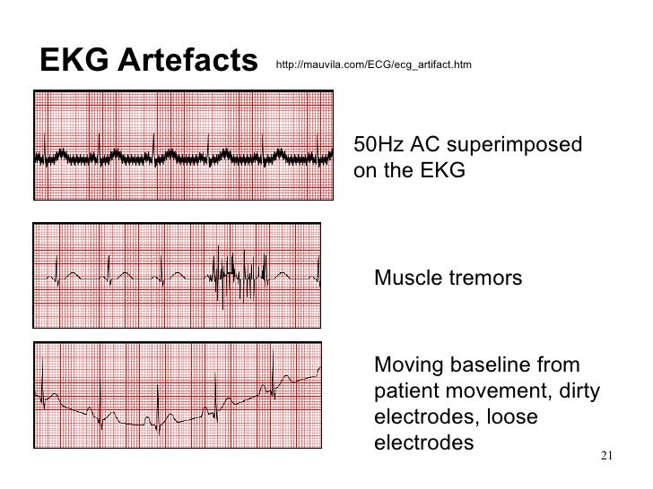 Biosignals andthermometry fin