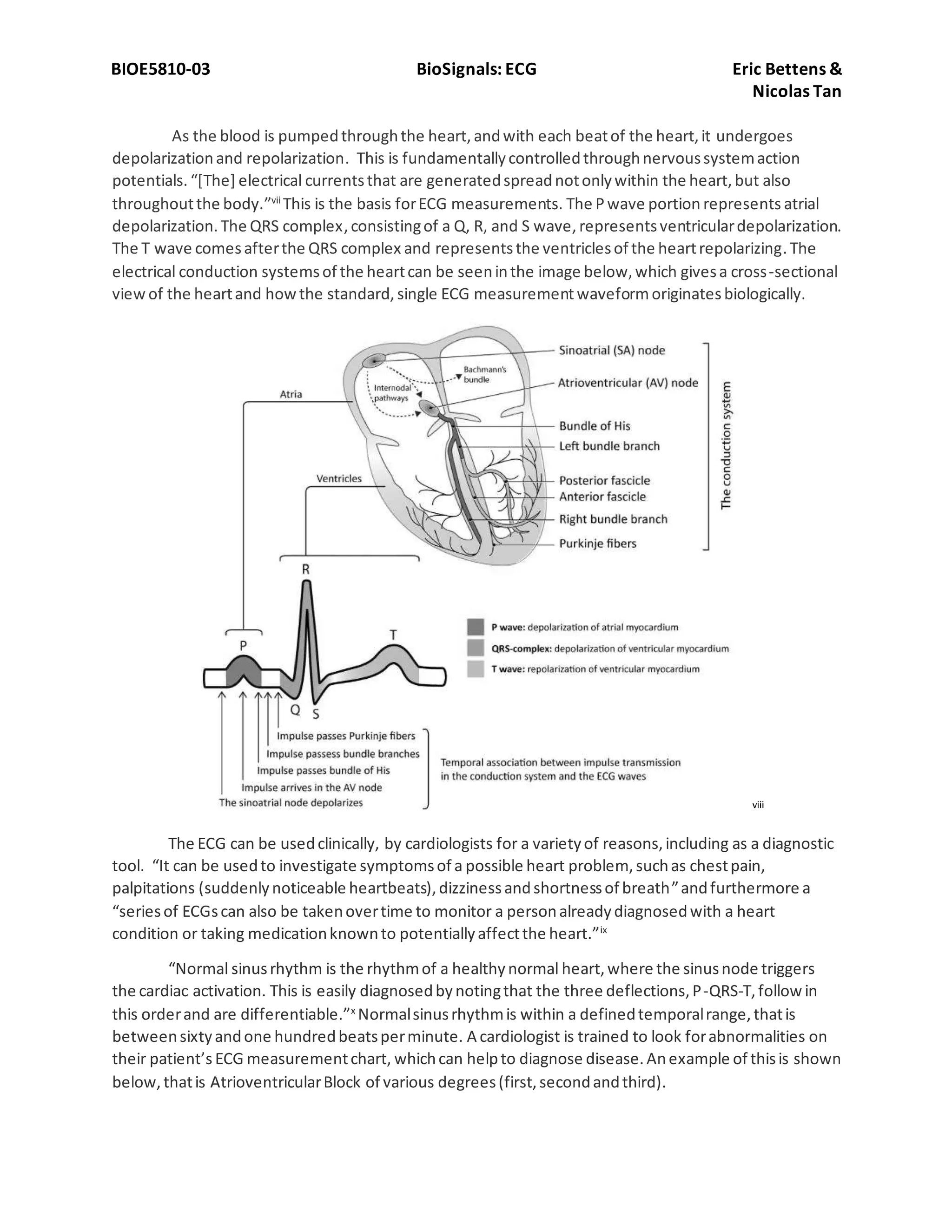 Digital BioSignal Processing: Characteristics of ECG Measurement | PDF ...