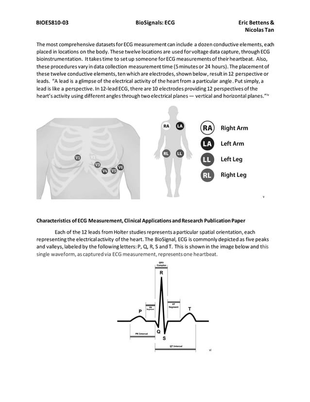 Digital BioSignal Processing: Characteristics of ECG Measurement | PDF ...