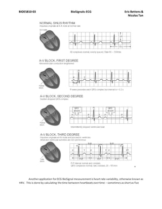 Digital BioSignal Processing: Characteristics of ECG Measurement | PDF ...