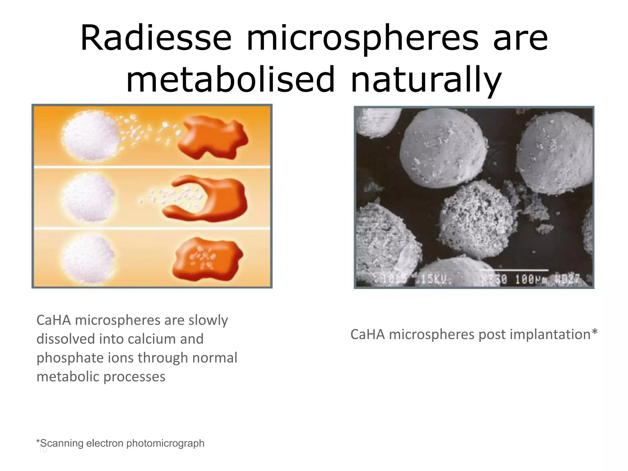 Biostimulant dermal fillers | PPTX