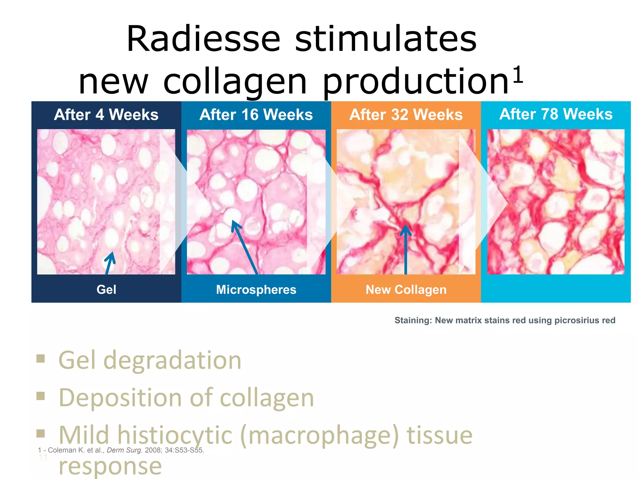Biostimulant dermal fillers | PPTX