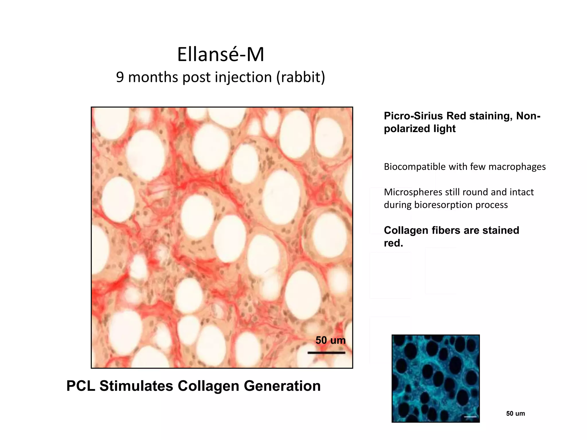 Biostimulant dermal fillers | PPTX