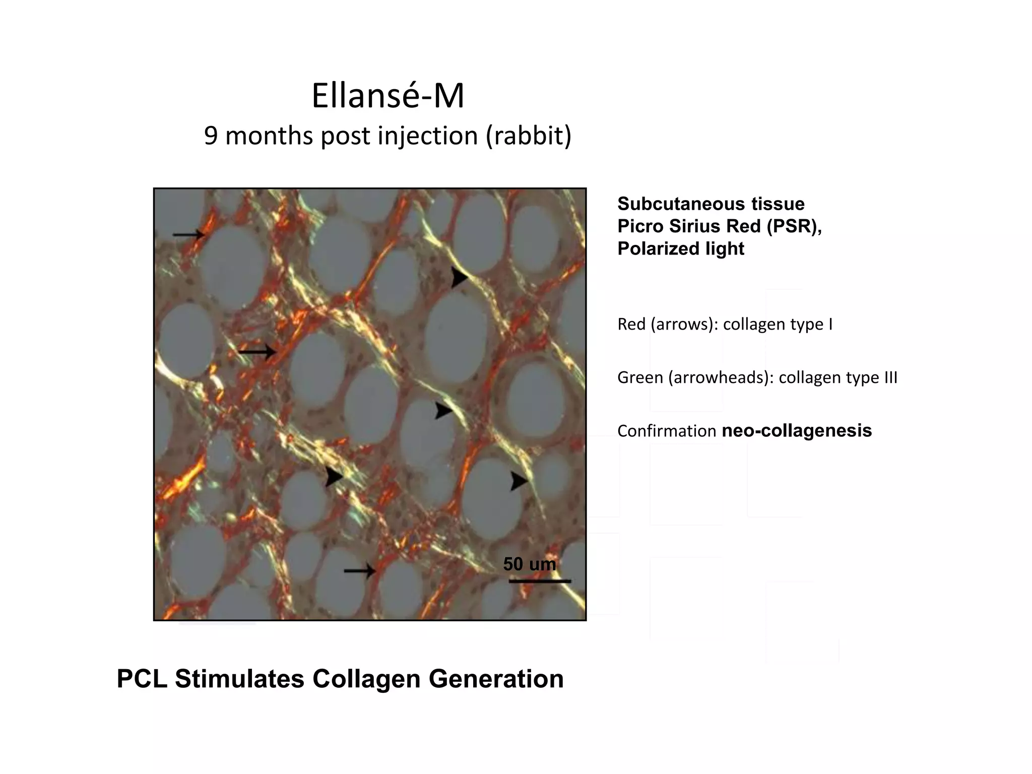 Biostimulant dermal fillers | PPTX