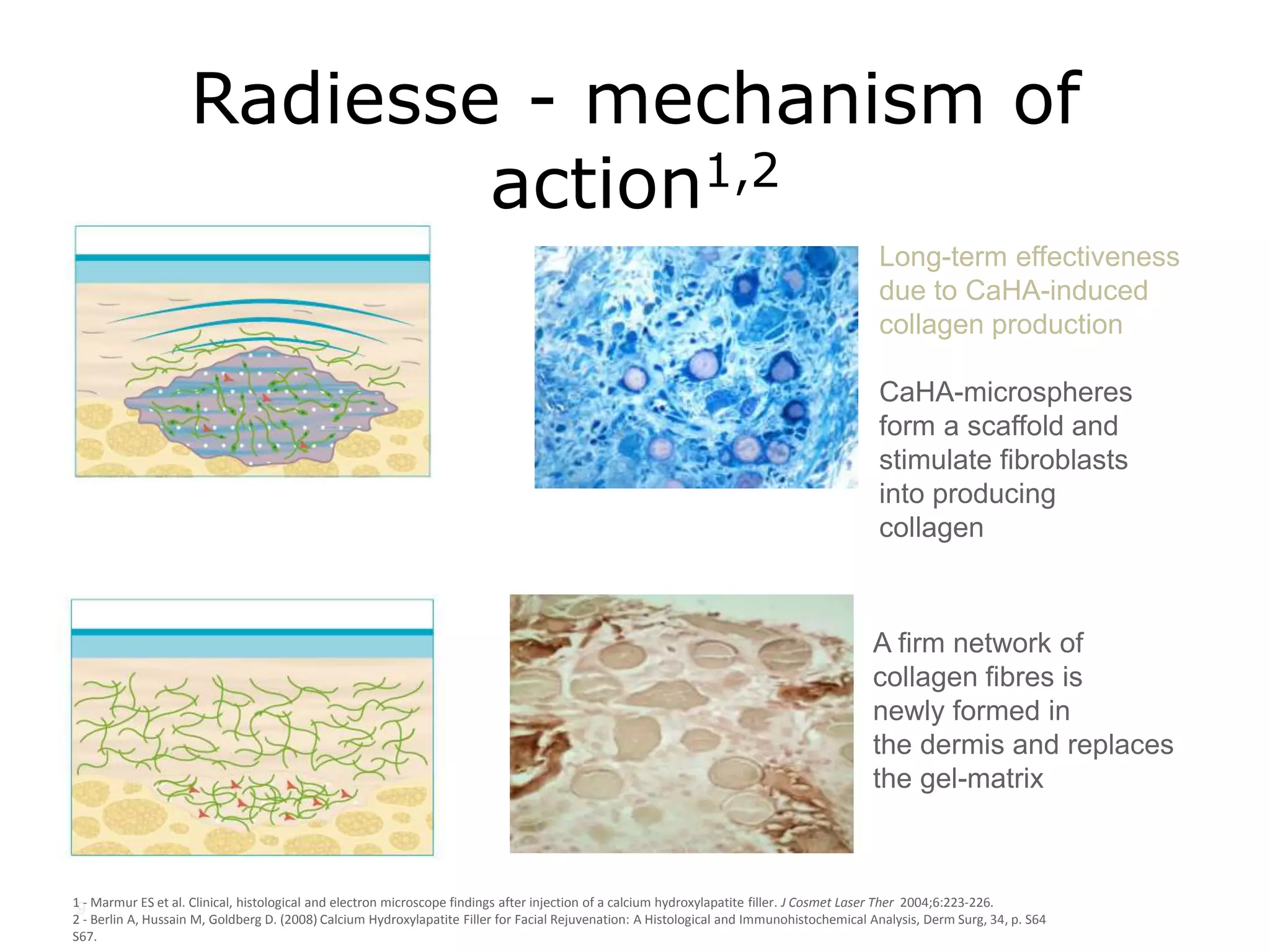 Biostimulant dermal fillers | PPTX