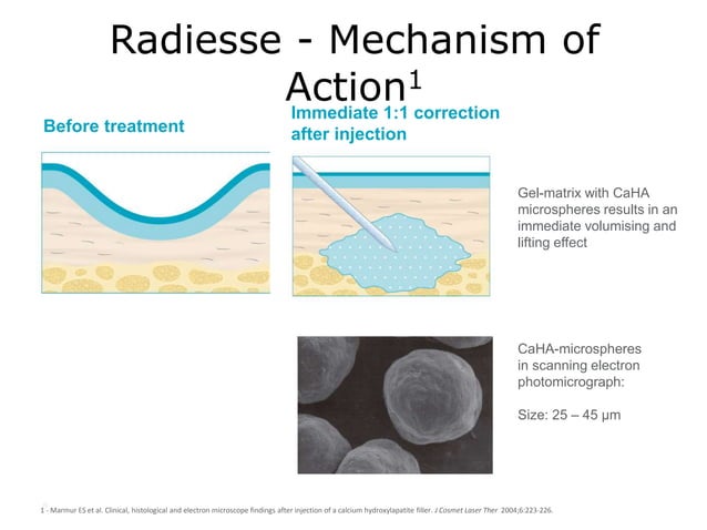 Biostimulant dermal fillers | PPTX | Skin and Dermatology | Diseases ...