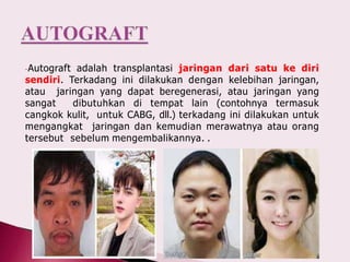 Bioteknologi Transplantasi Organ.pptx