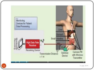 Biotelemetry and radio pill | PDF