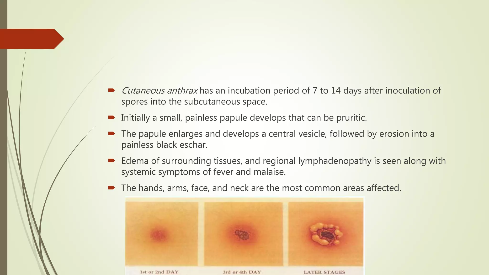 Bioterrorism | PPTX