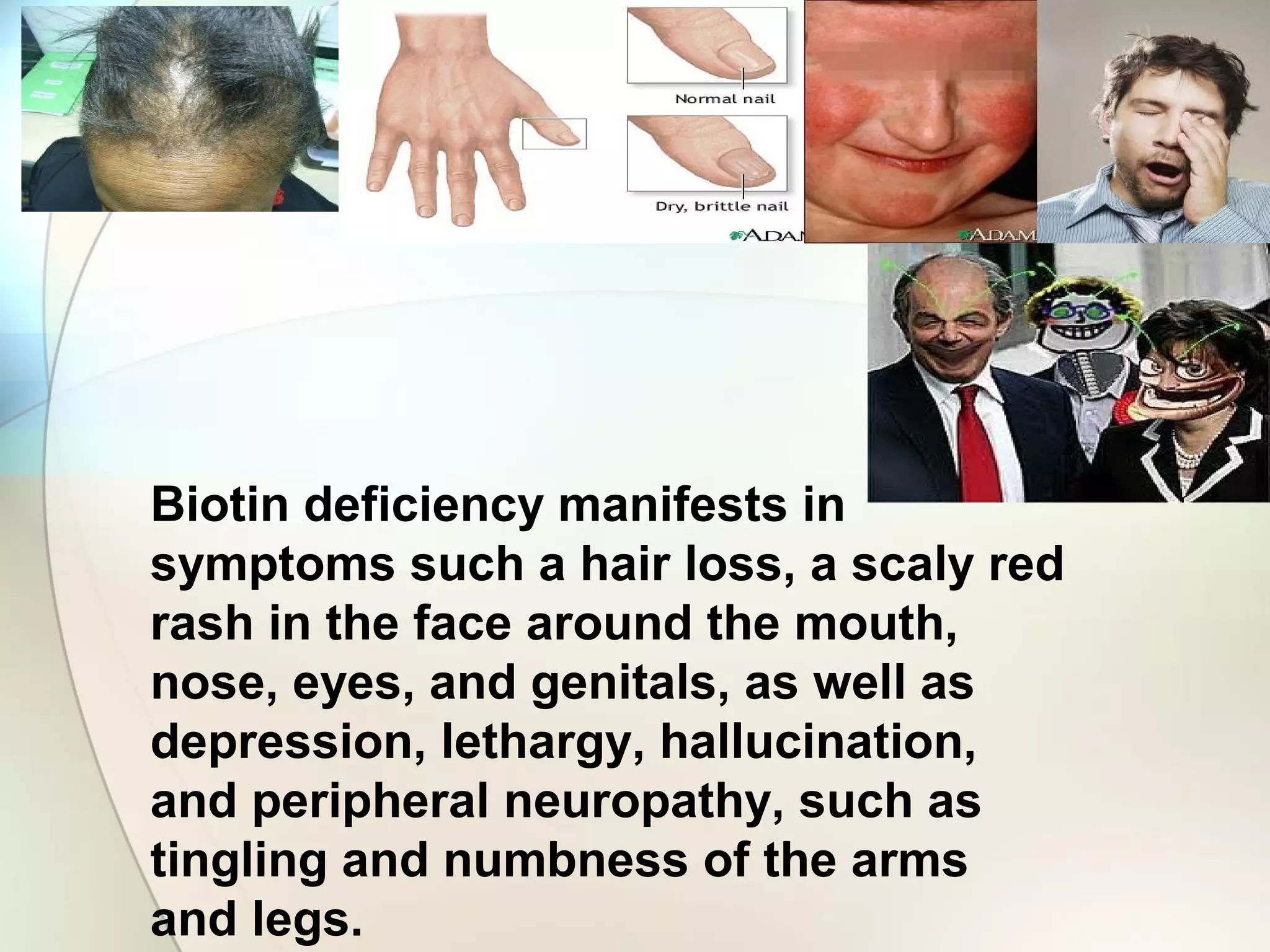 Biotin ppt. | PPT