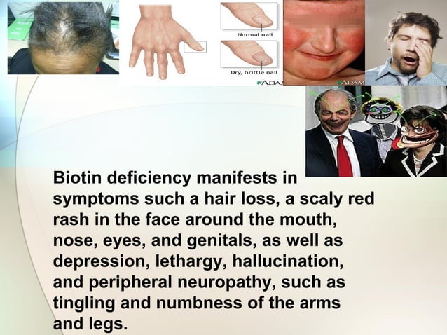 Biotin ppt. | PPT | Endocrine and Metabolic Diseases | Diseases and ...